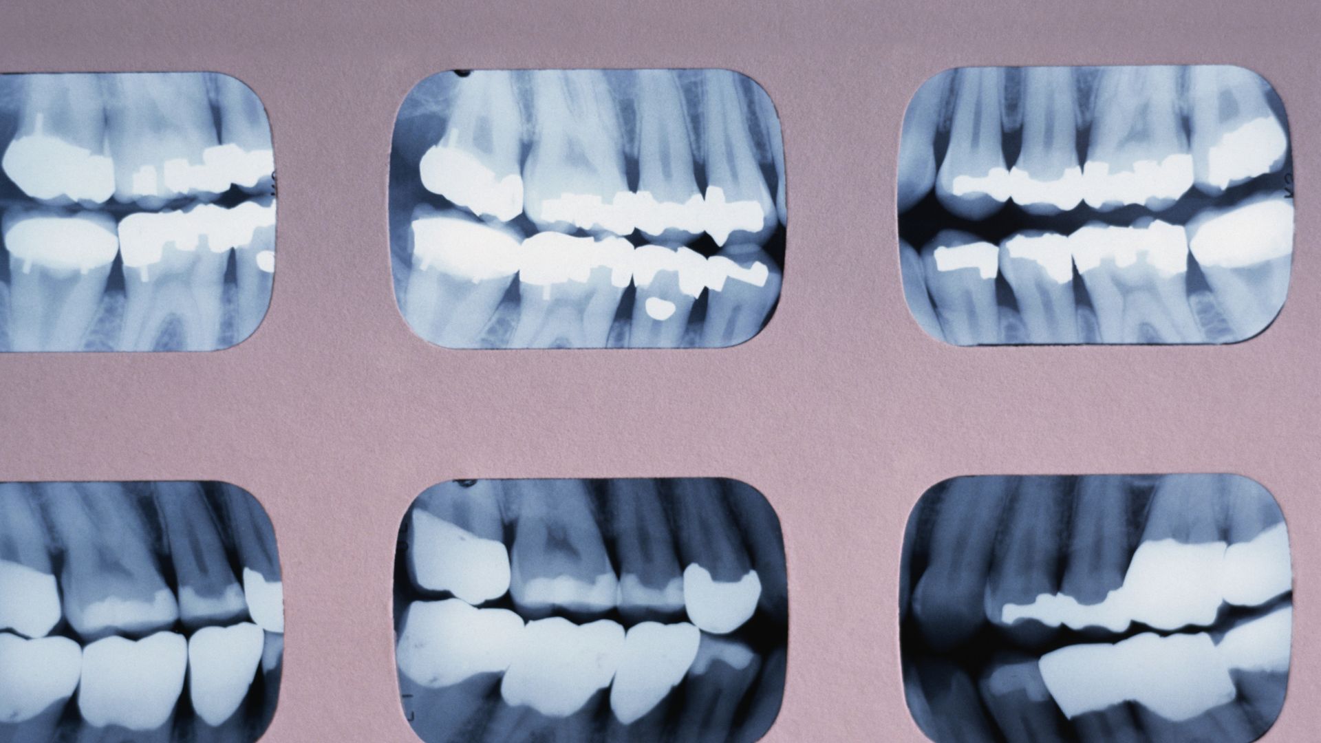 Pet Digital Dental X-Rays In Tucson, AZ | Cimarron Animal Hospital